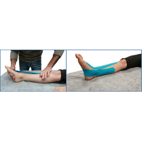 Vendaje neuromuscular, activa recuperación muscular sin limitar el ...